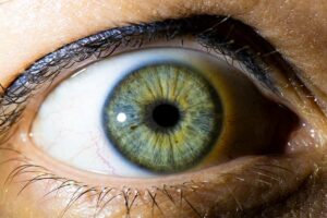 Professional eye photography tutorial | Iris photos with no reflection