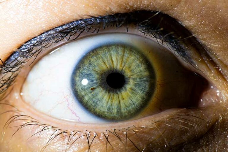 Professional eye photography tutorial | Iris photos with no reflection