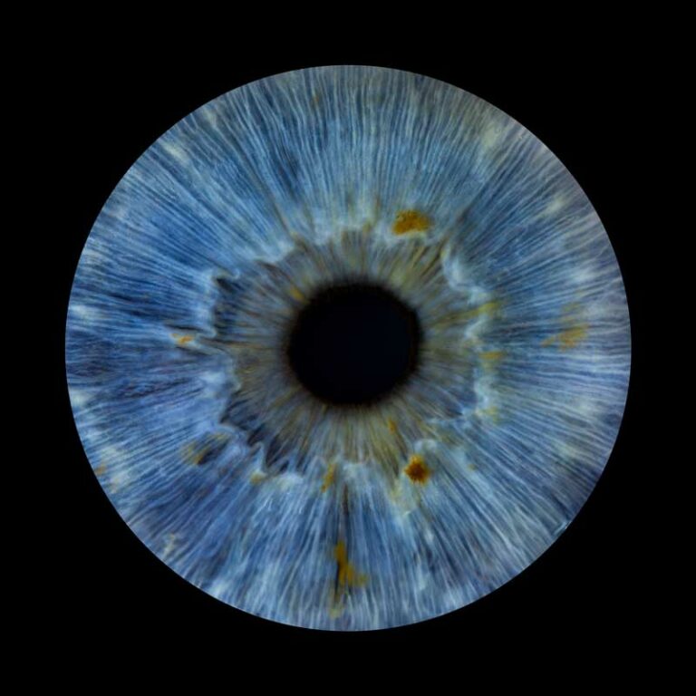 Professional eye photography tutorial | Iris photos with no reflection