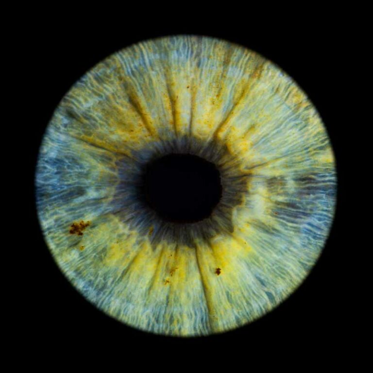 Professional eye photography tutorial | Iris photos with no reflection