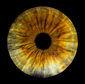 Professional eye photography tutorial | Iris photos with no reflection