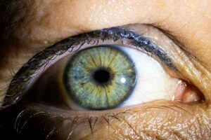 Professional eye photography tutorial | Iris photos with no reflection